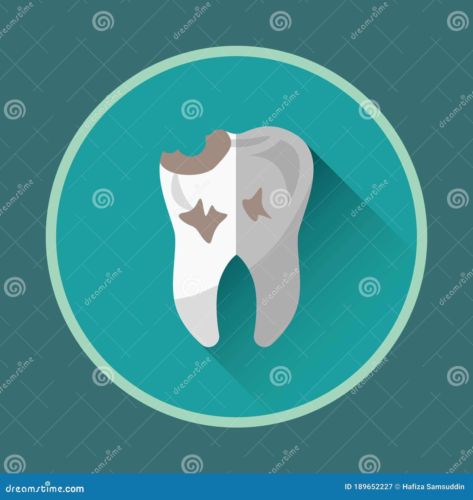 Cavity in Tooth. Vector Illustration Decorative Design Stock Vector ...