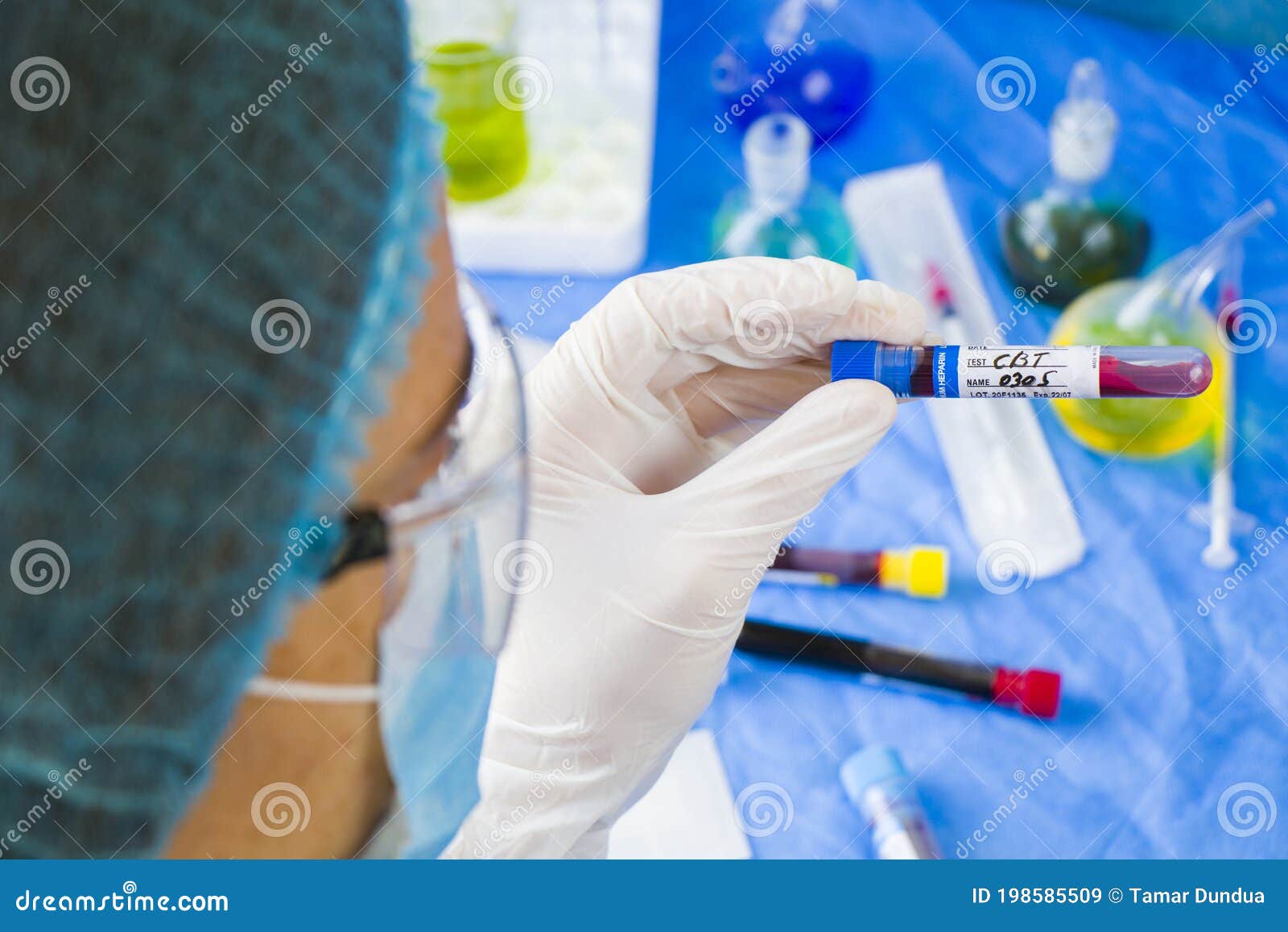 CBC Blood Test Tube Sample in Doctors Hand Stock Image - Image of ...