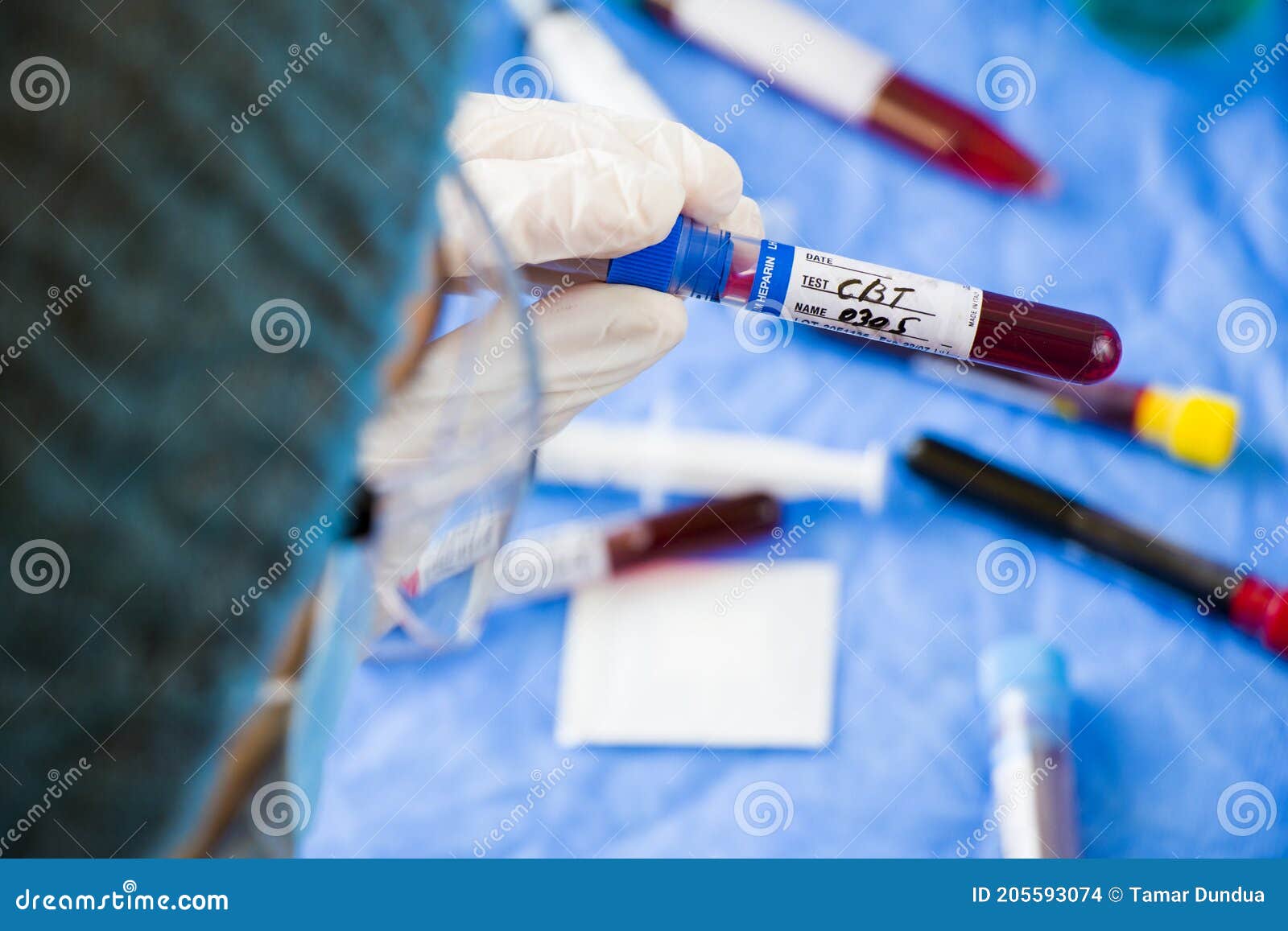 CBC Blood Test Tube Sample in Doctors Hand Stock Photo - Image of ...