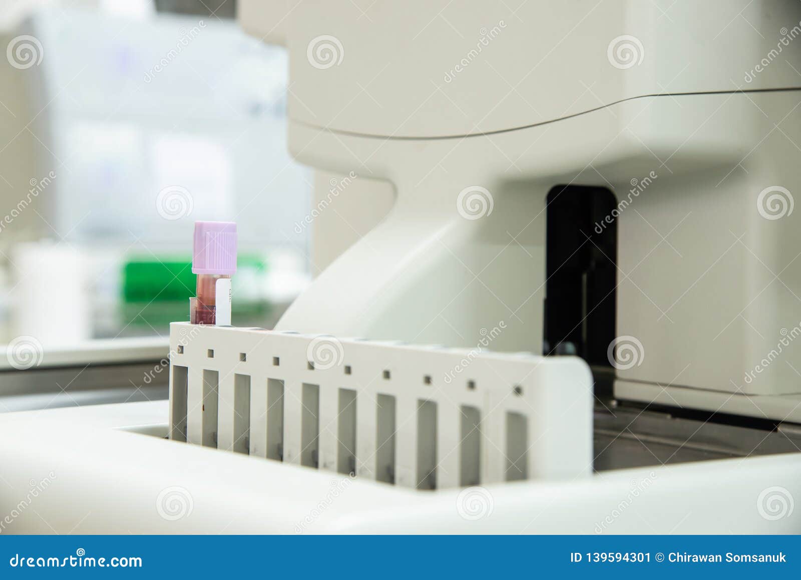 CBC in laboratory stock image. Image of medical, experiment - 139594301