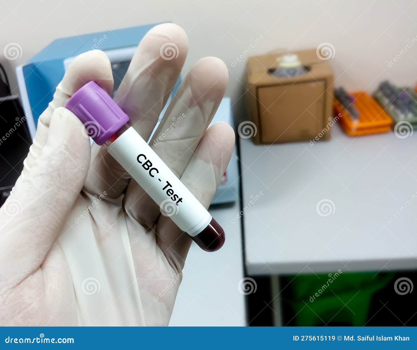 CBC Test. Complete Blood Count Stock Image - Image of anemia, leukemia ...