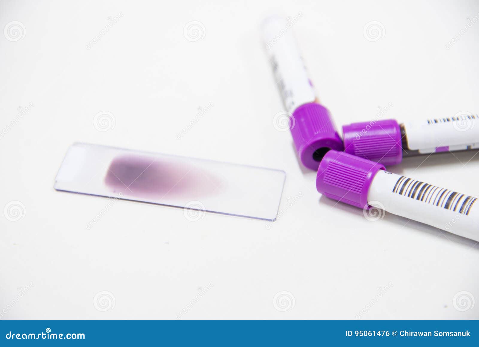 CBC test stock photo. Image of examine, laboratory, complete - 95061476