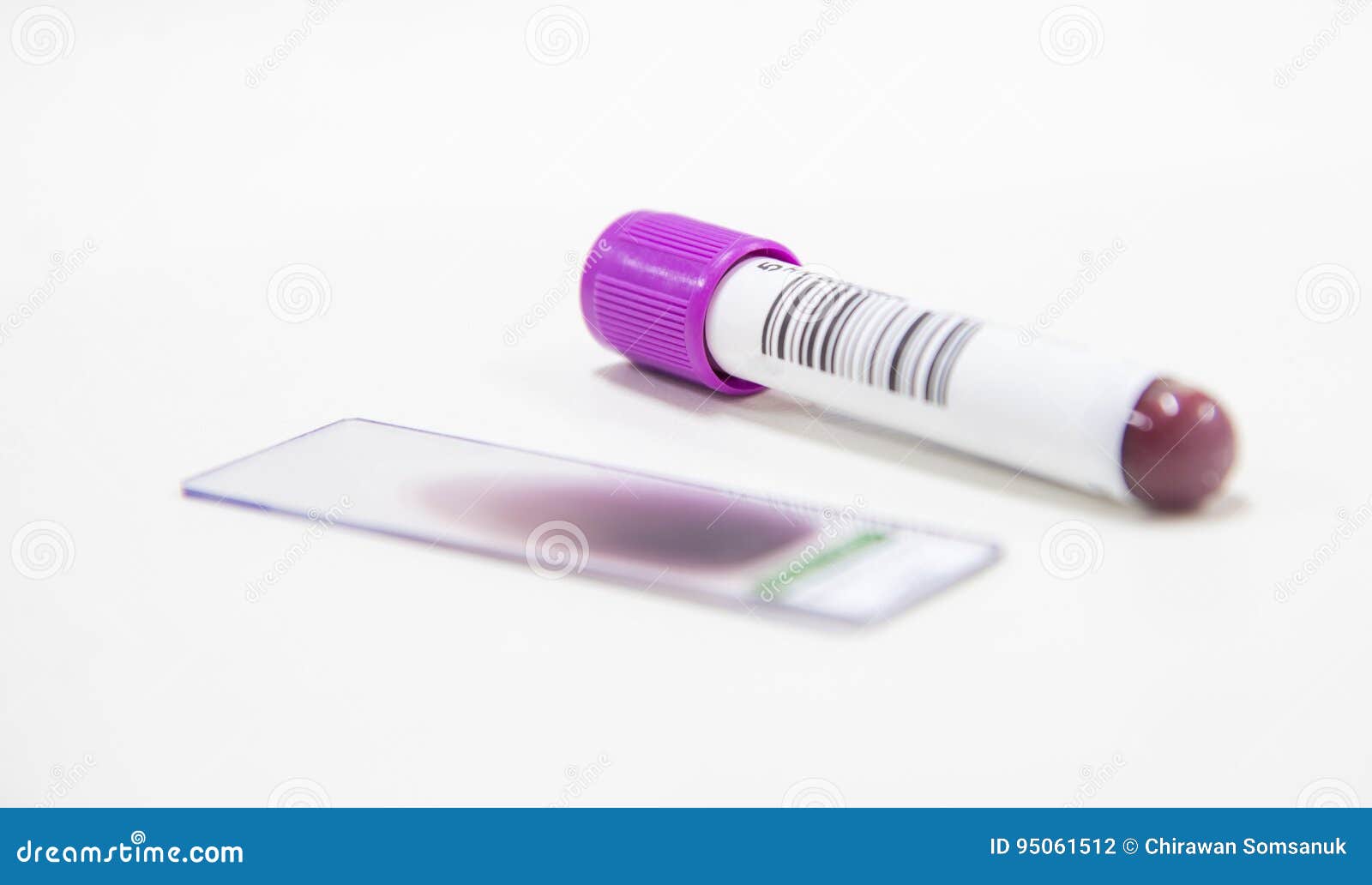 CBC test stock photo. Image of healthcare, hospital, hand - 95061512