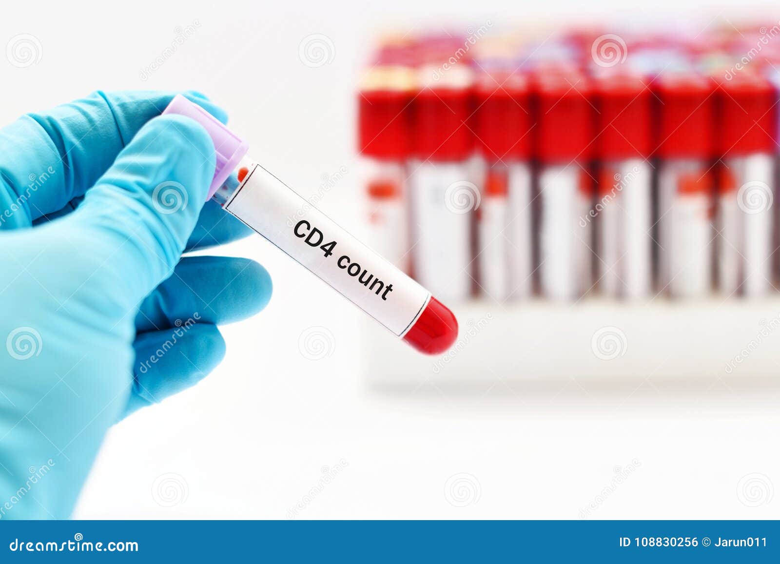 CD4 count test stock photo. Image of sample, chemical - 108830256
