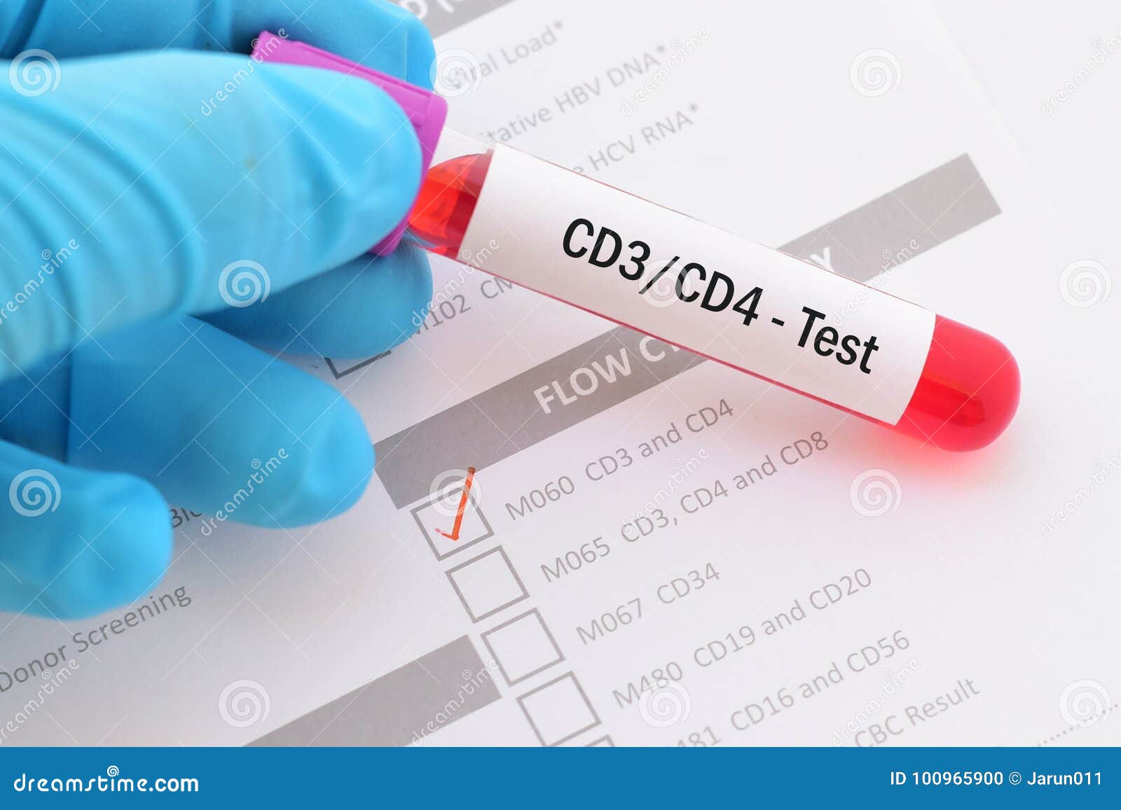 CD3/CD4 test stock photo. Image of white, technology - 100965900