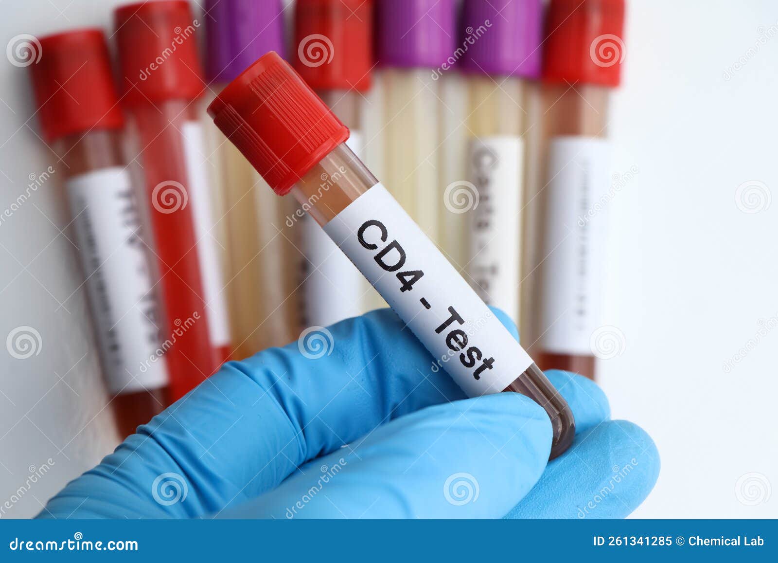CD4 Test To Look for Abnormalities from Blood Stock Image - Image of ...