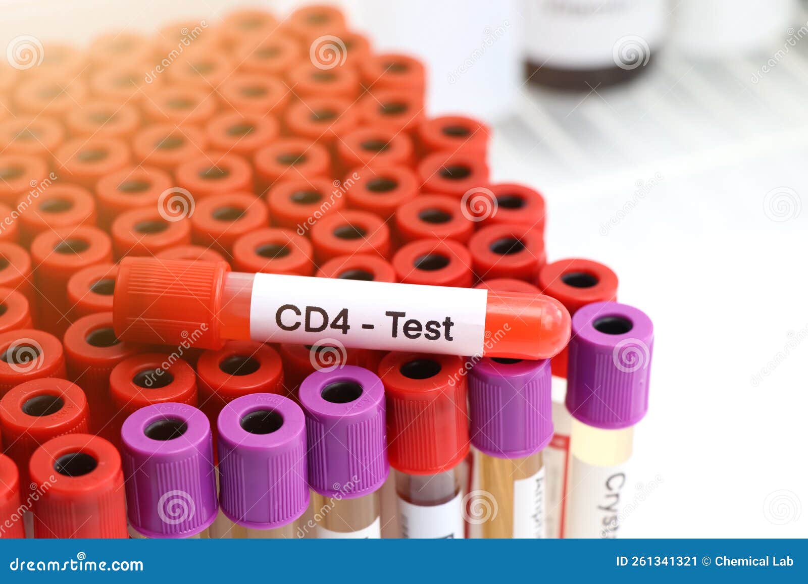 CD4 Test To Look for Abnormalities from Blood Stock Image - Image of ...