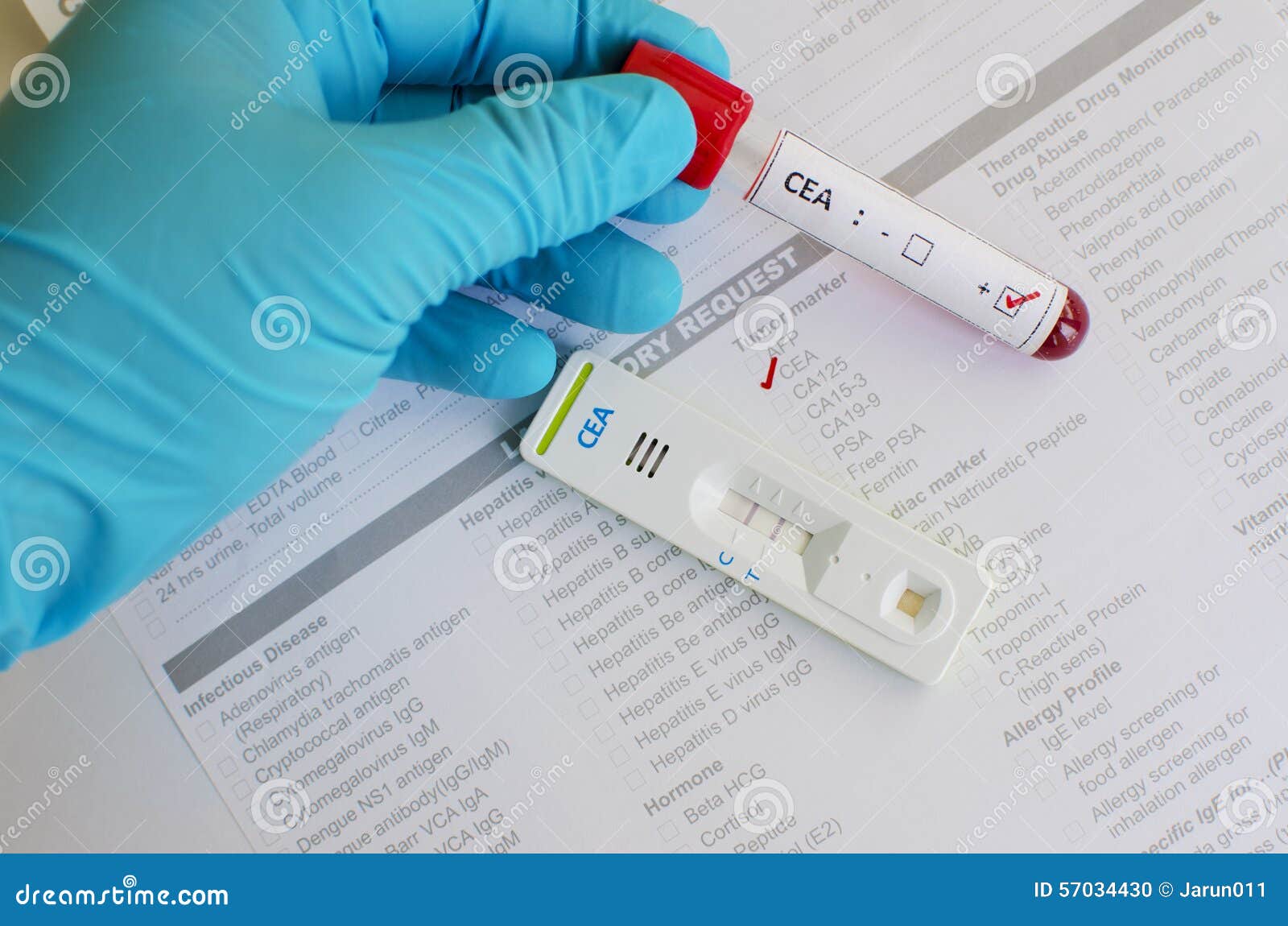CEA Or Carcinoembryonic Antigen Positive By Using Rapid Test Stock ...