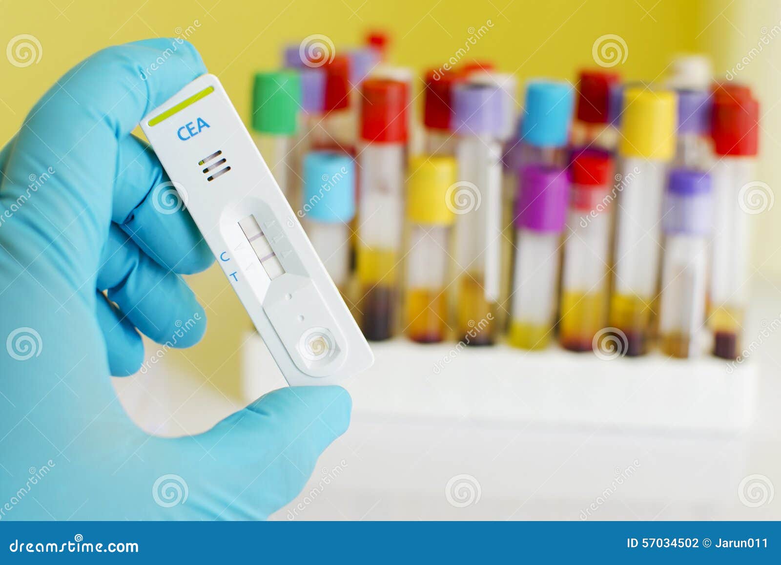 CEA positive stock photo. Image of medicine, care, immunology - 57034502