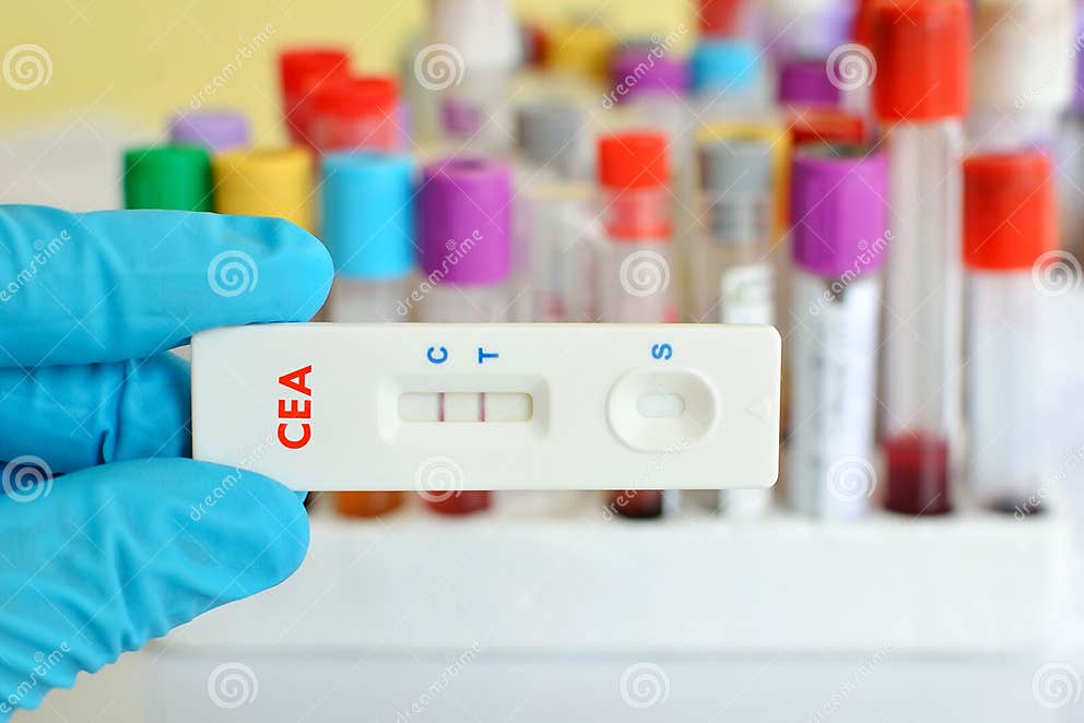 CEA positive stock image. Image of illness, science, health - 80025861