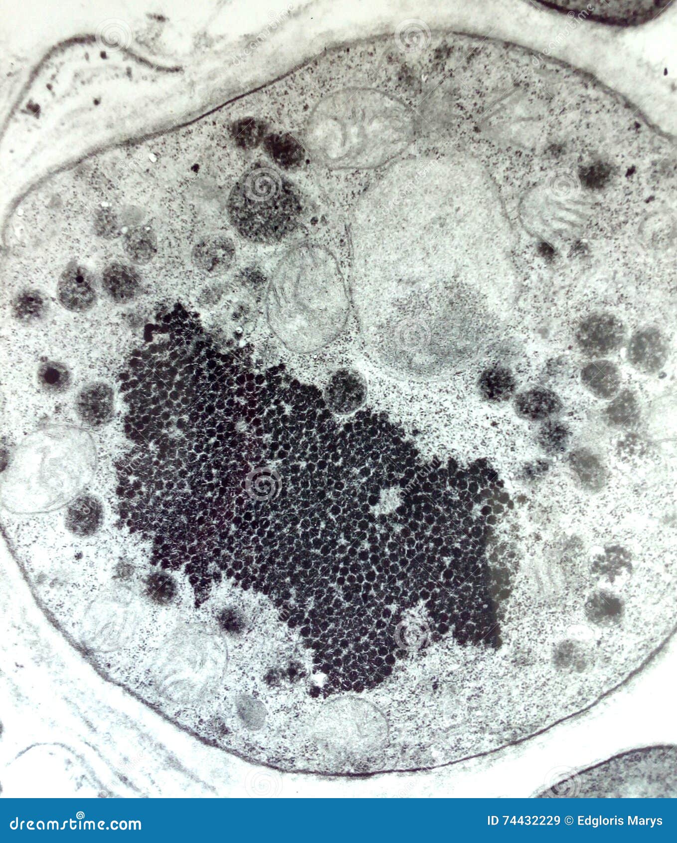 Virus Infected Red Wooden Man Communicate With People Stand In A ...