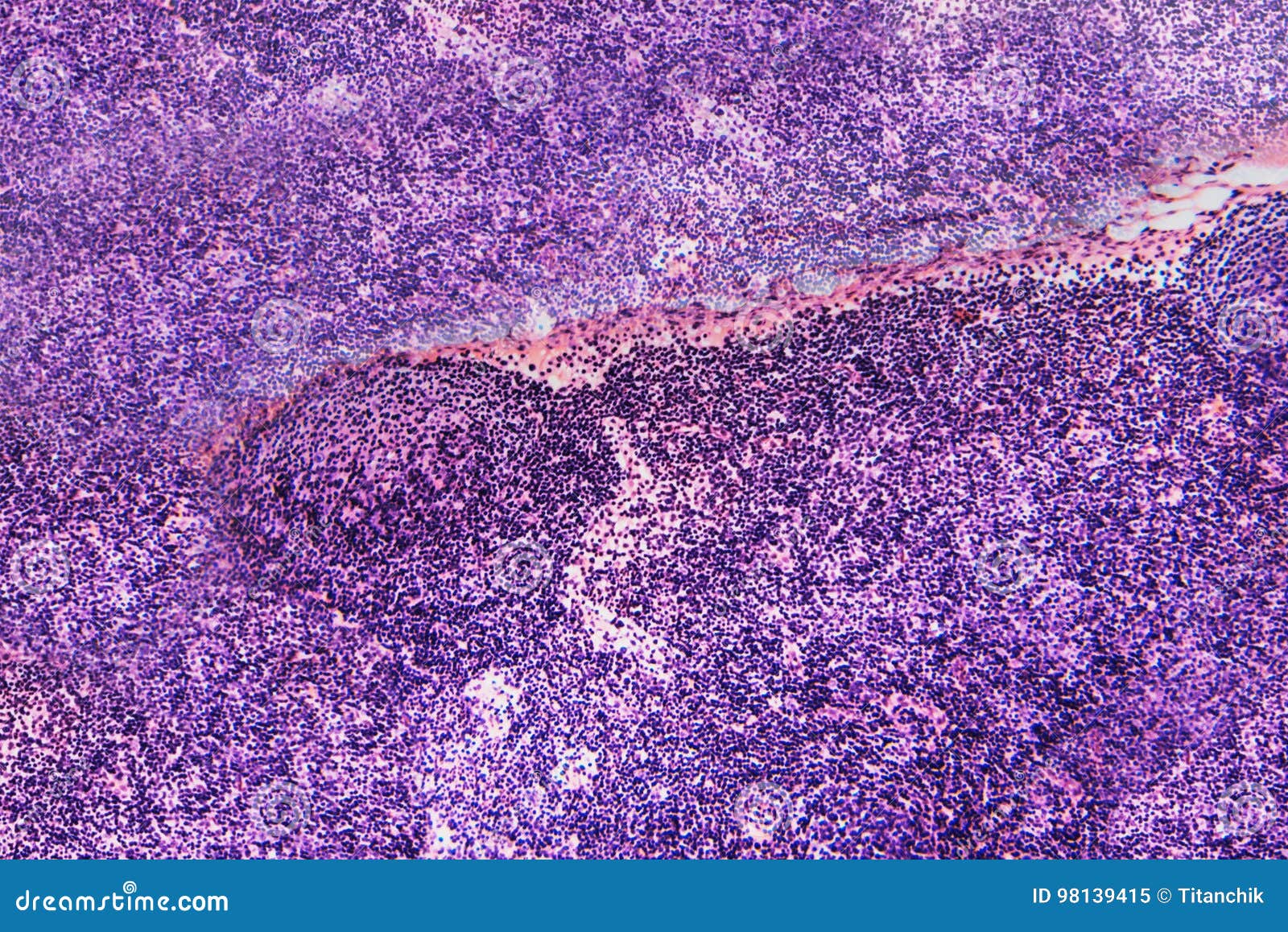 Cell lymph node dog stock image. Image of healthy, leukocyte - 98139415