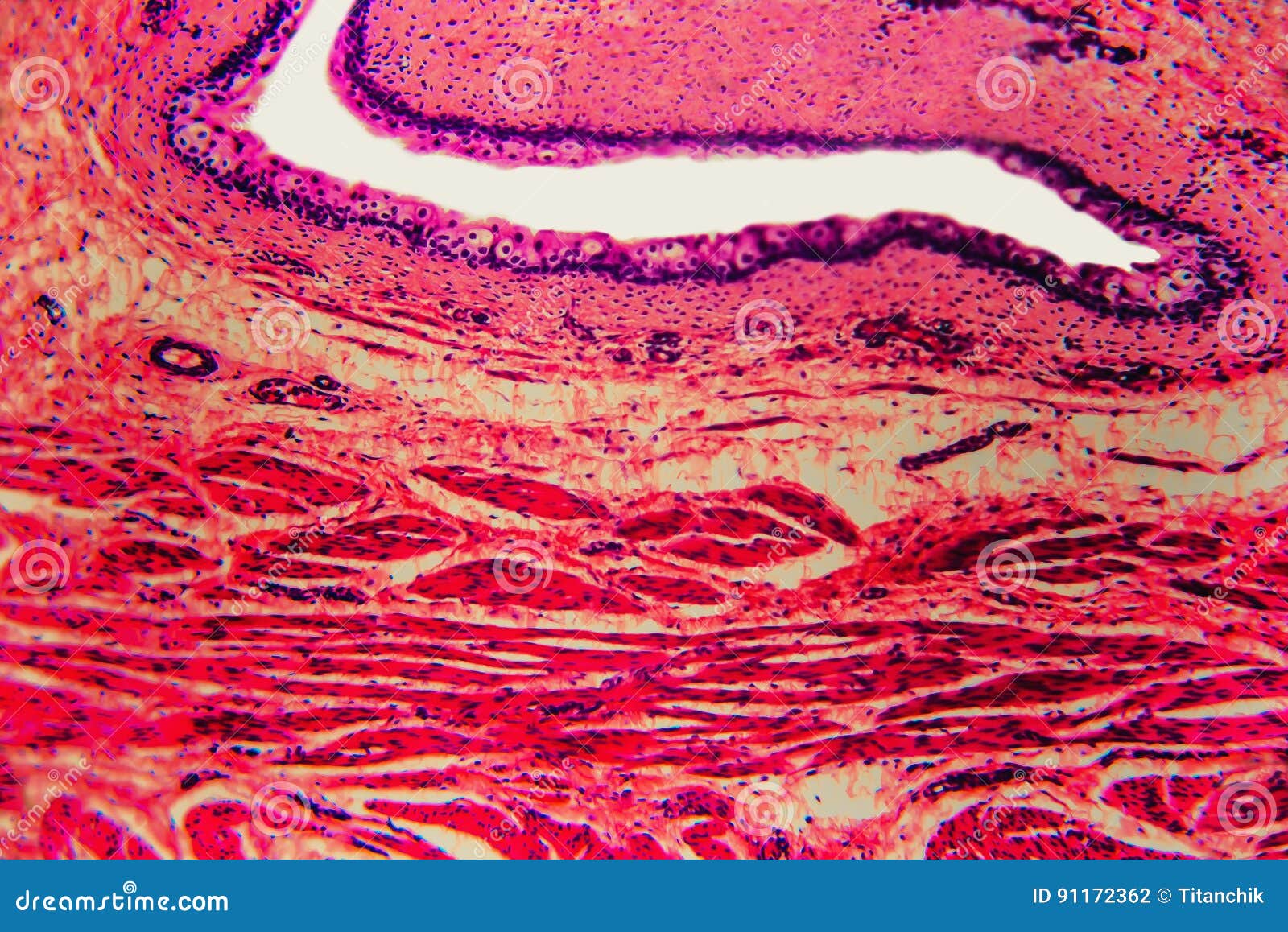 Cell Microscopic- Bladder of the Cat Stock Photo - Image of cancer ...