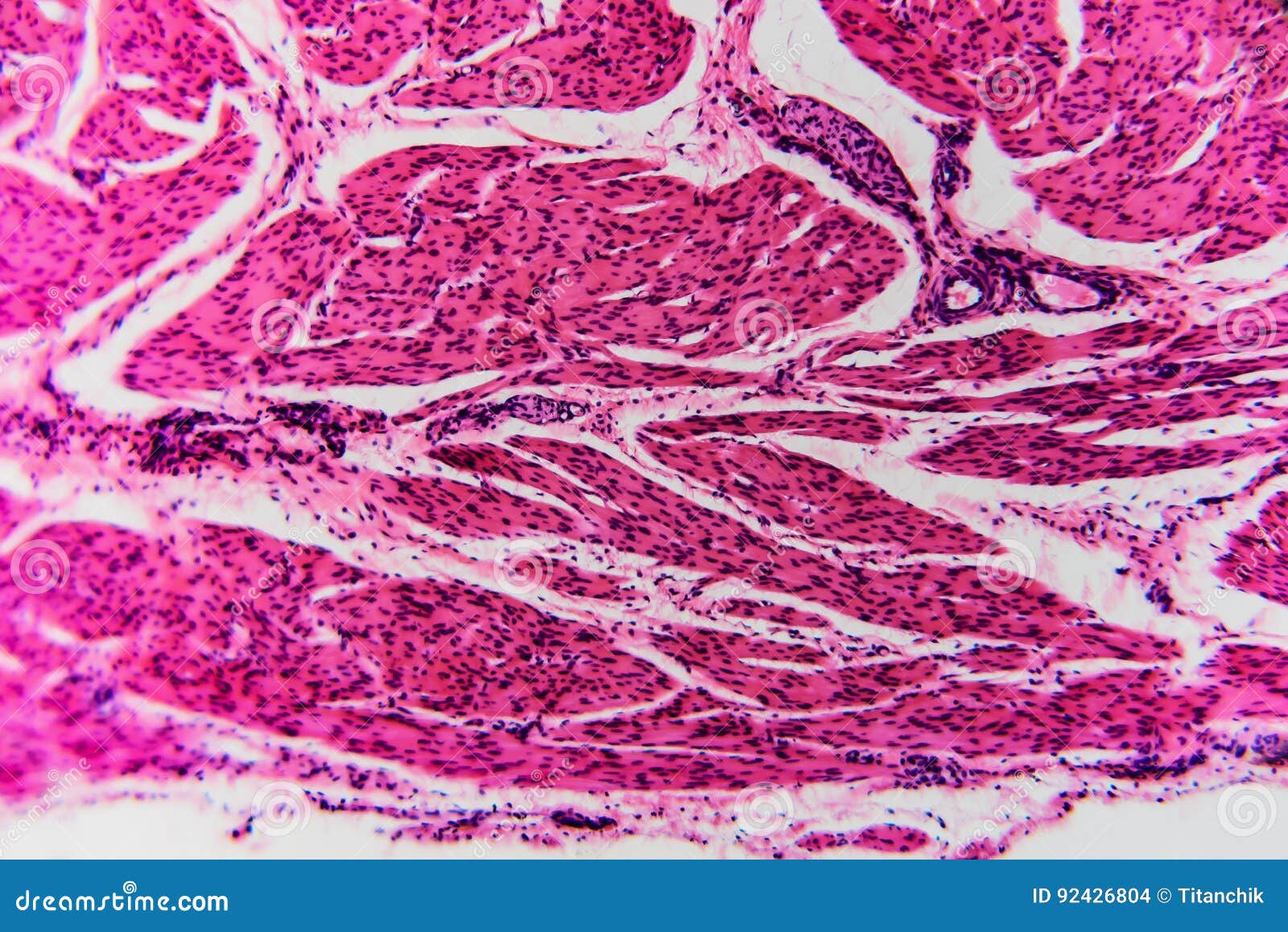 Cell Microscopic- Bladder of the Cat Stock Photo - Image of rectum ...