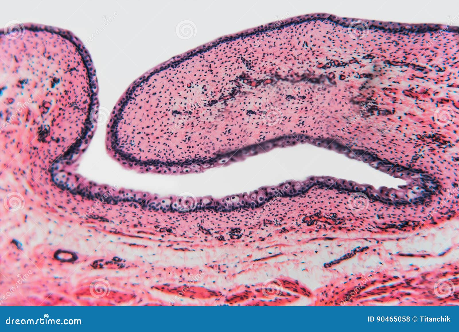 Cell Microscopic- Bladder Cat Stock Photo - Image of animal, botanic ...