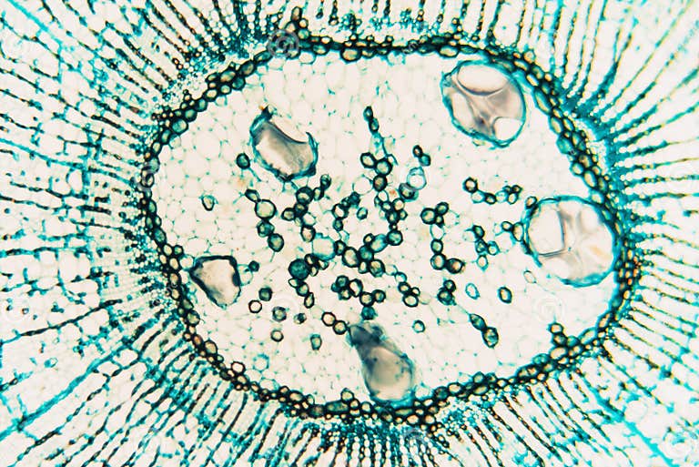 Cell Microscopic- Branches Linden Stock Photo - Image of training ...