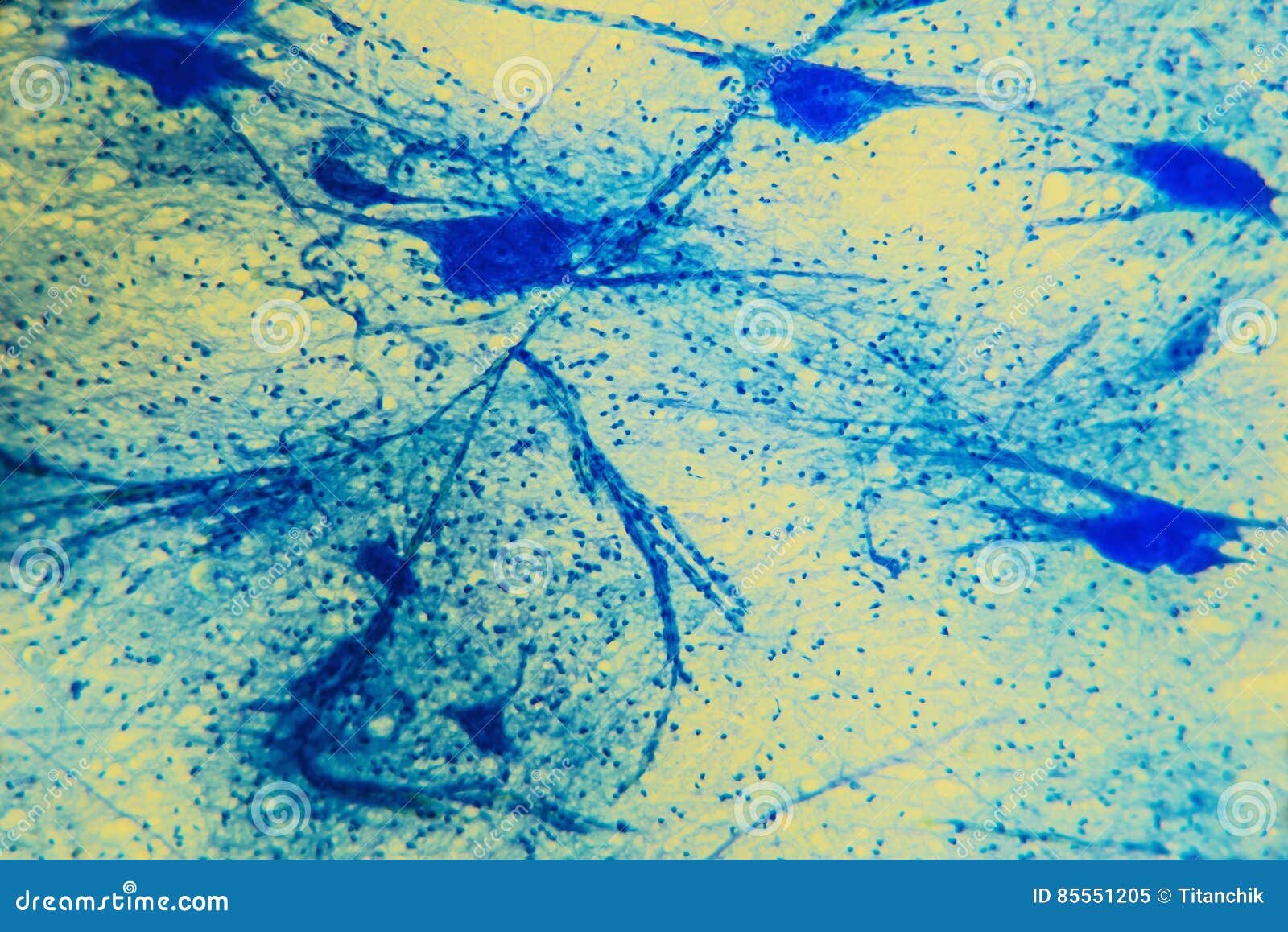 Cell Microscopic- Neuron Tissue Stock Image - Image of anatomy, motor ...