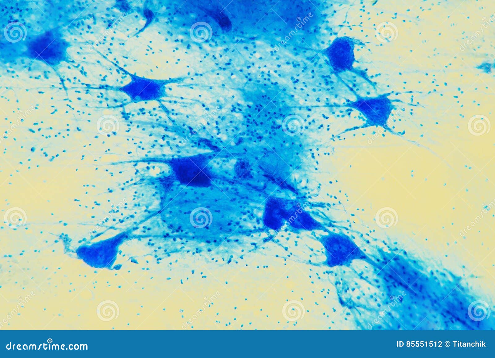 Cell Microscopic- Neuron Tissue Stock Photo - Image of microscoop ...
