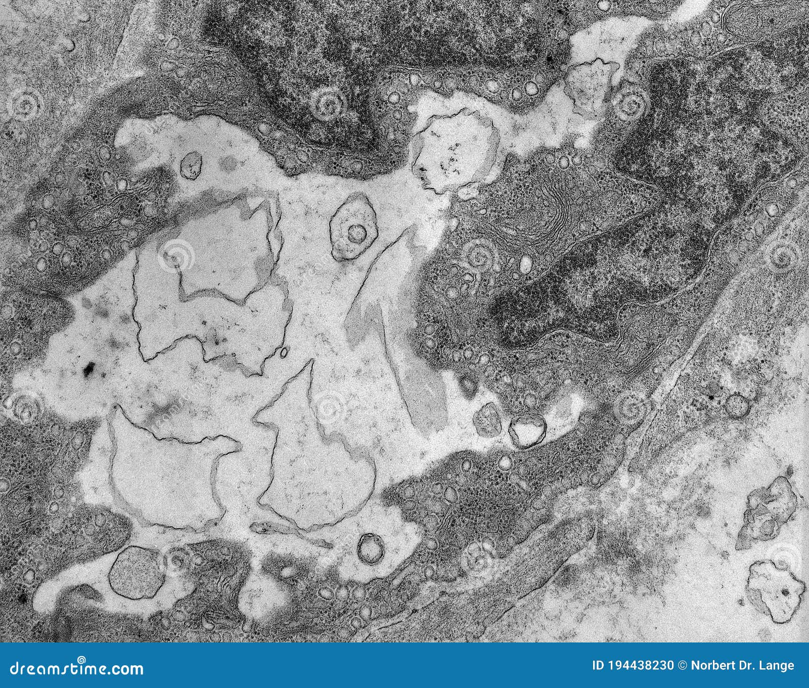 Electron Microscope Images Of Cell Organelles
