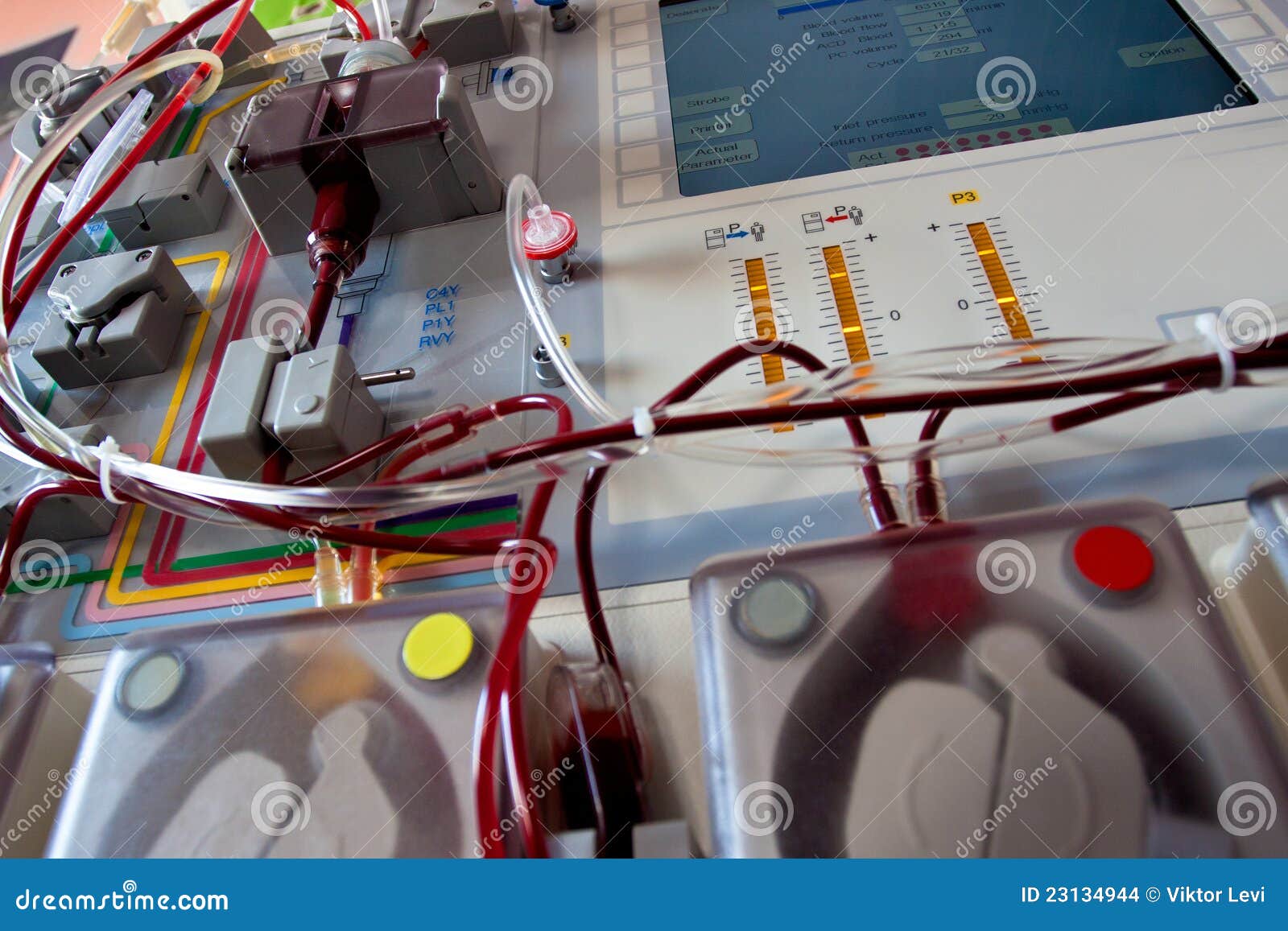 Cell Saver Device for Blood Reinfusion Stock Photo - Image of clinic ...