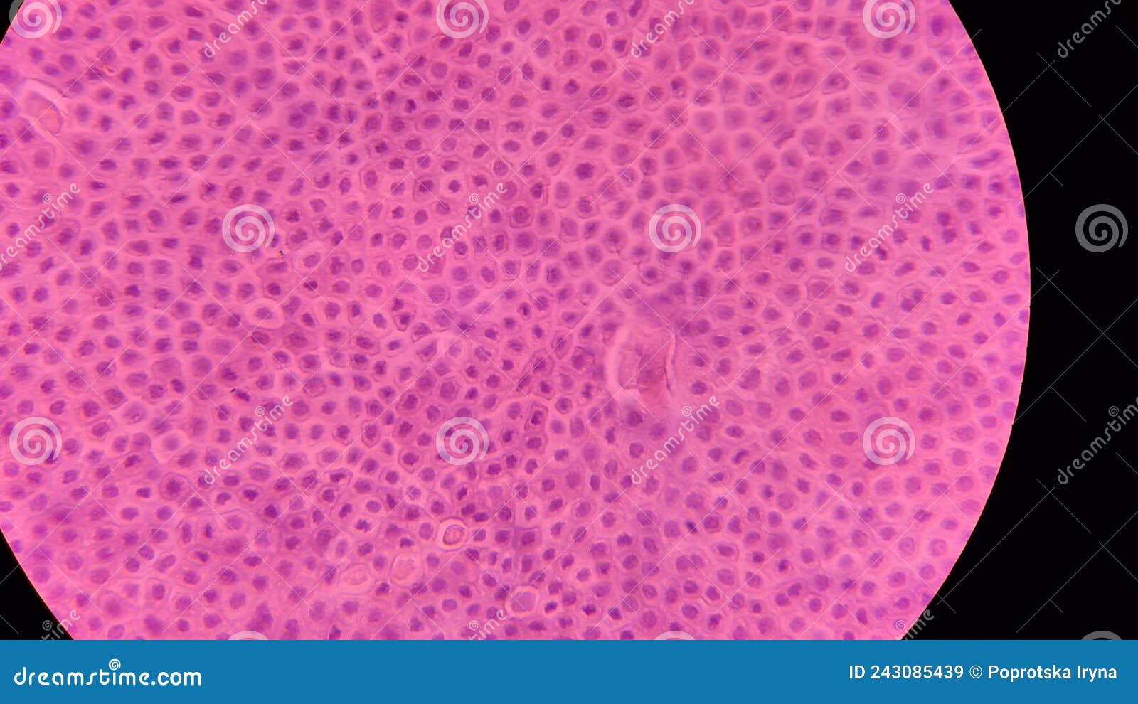 Cell Structure of Human Amnion Stock Image - Image of fetus, membrane ...