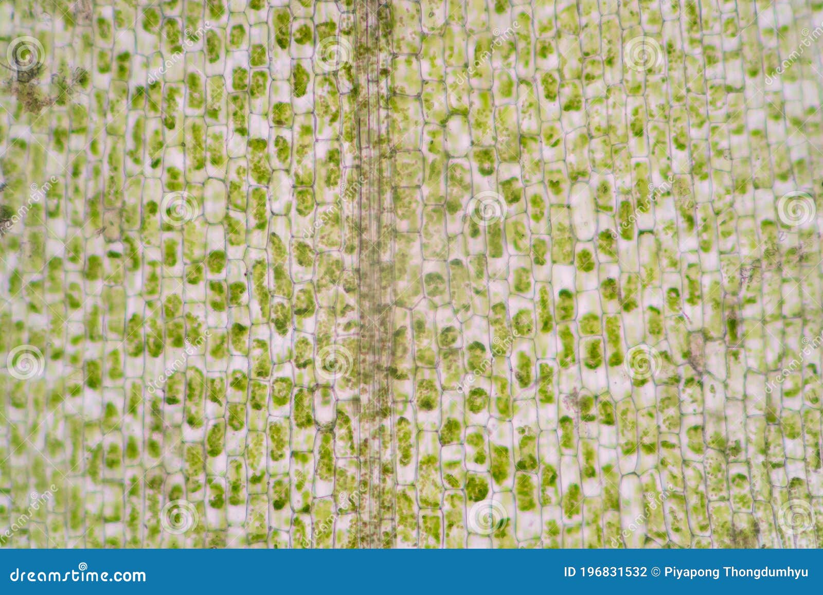 Cell Structure Hydrilla, View Of The Leaf Surface Showing Plant Cells ...