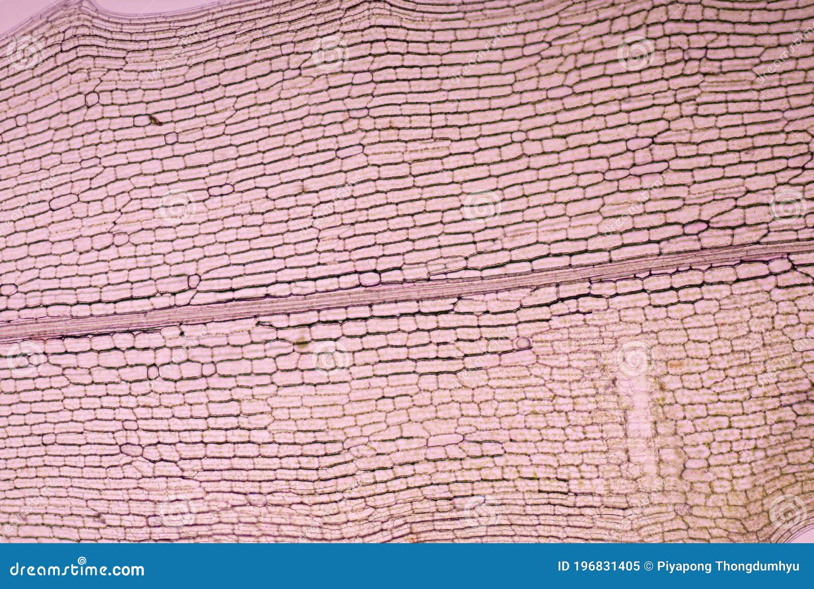 Cell Structure Hydrilla, View of the Leaf Surface Showing Plant Cells ...