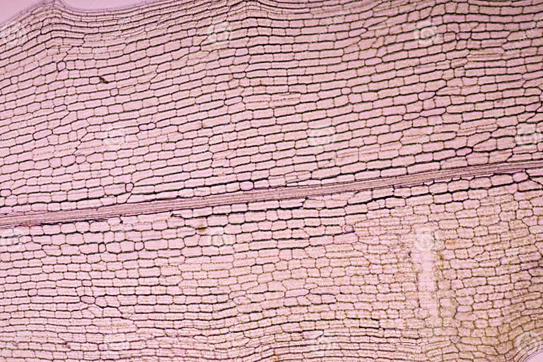 Cell Structure Hydrilla, View of the Leaf Surface Showing Plant Cells ...