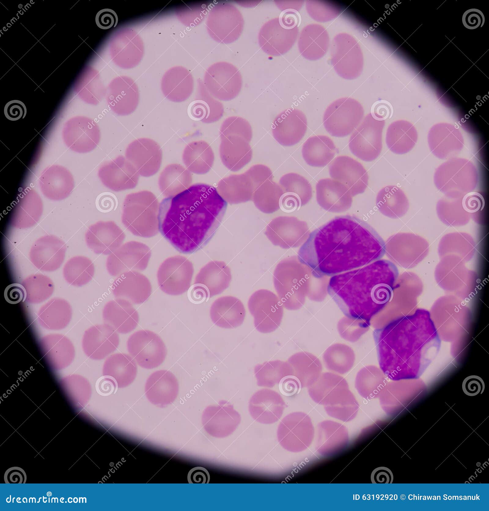 Red Blood Cells In Bone Marrow