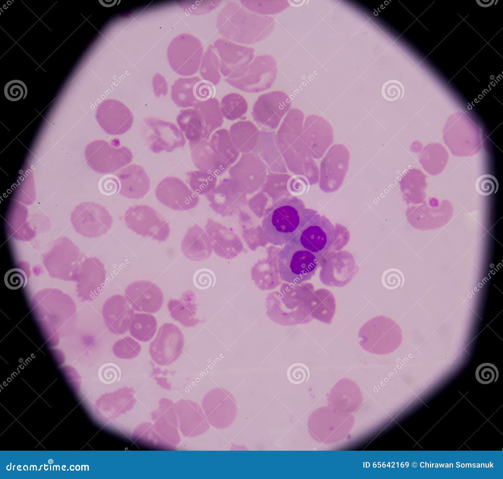 Red Blood Cells In Bone Marrow