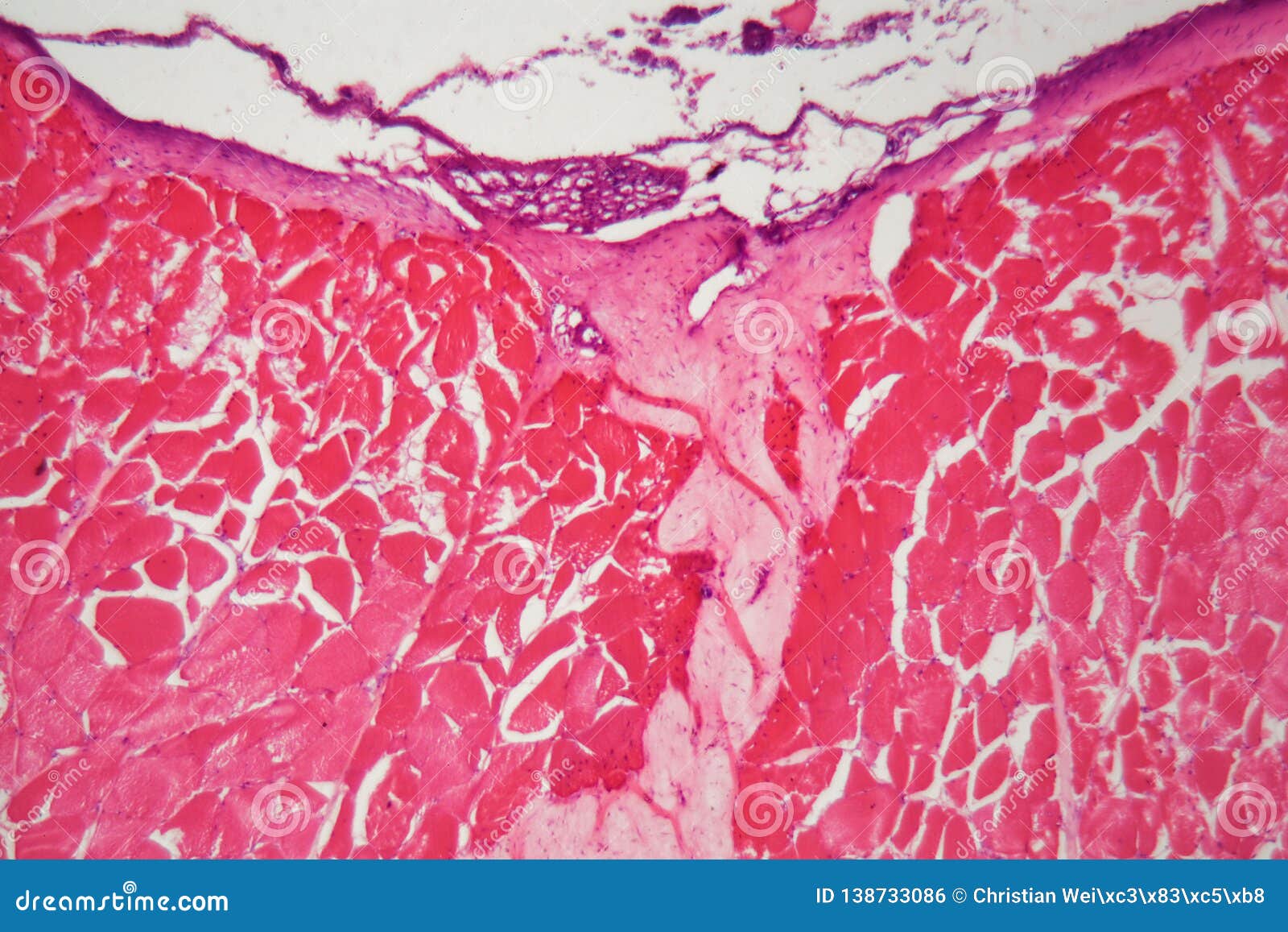 Fish Skin Injured by Chemicals Under the Microscope Stock Photo - Image ...