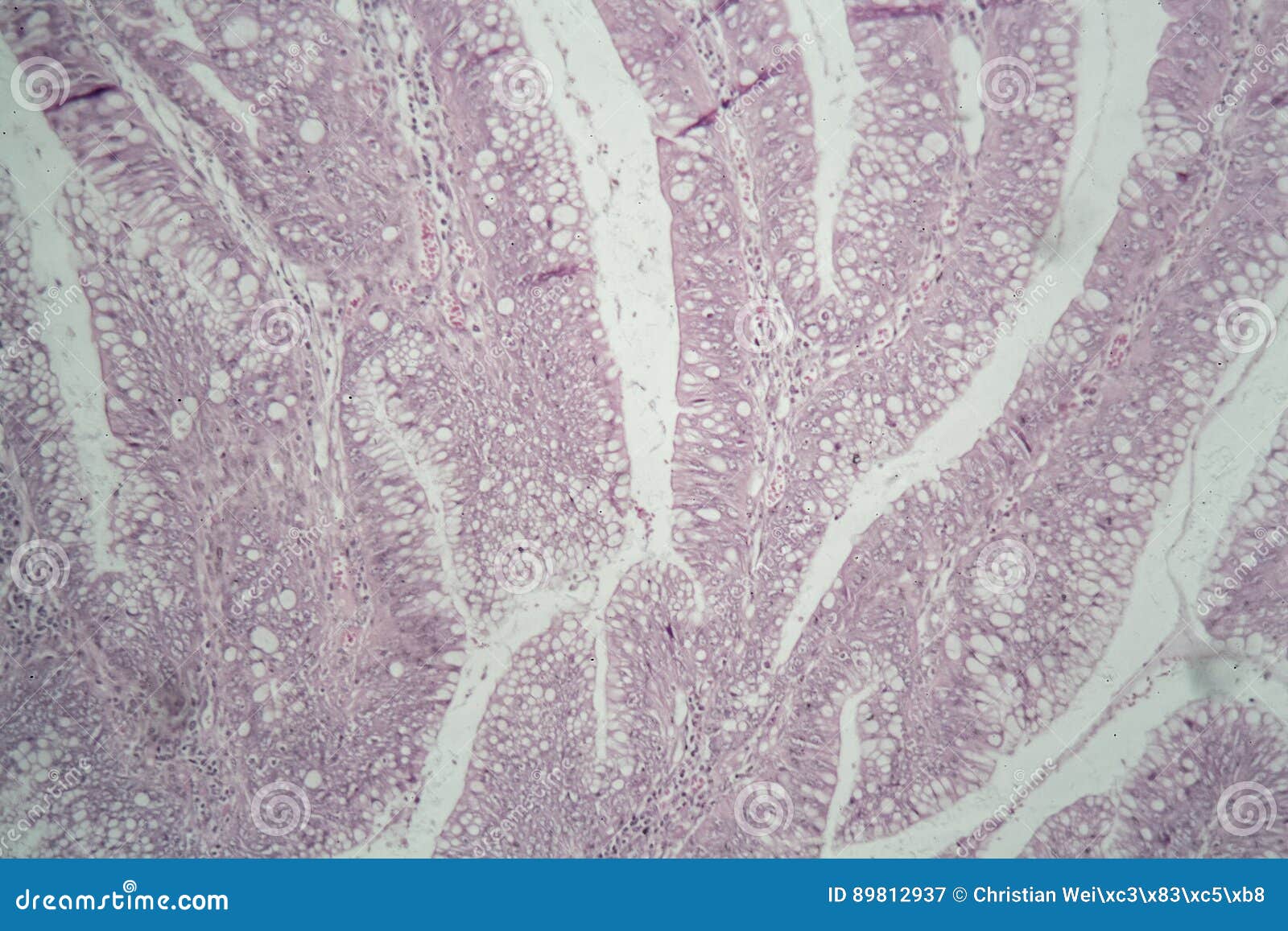 Cells of a Human Large Intestine Under the Microscope Stock Image ...