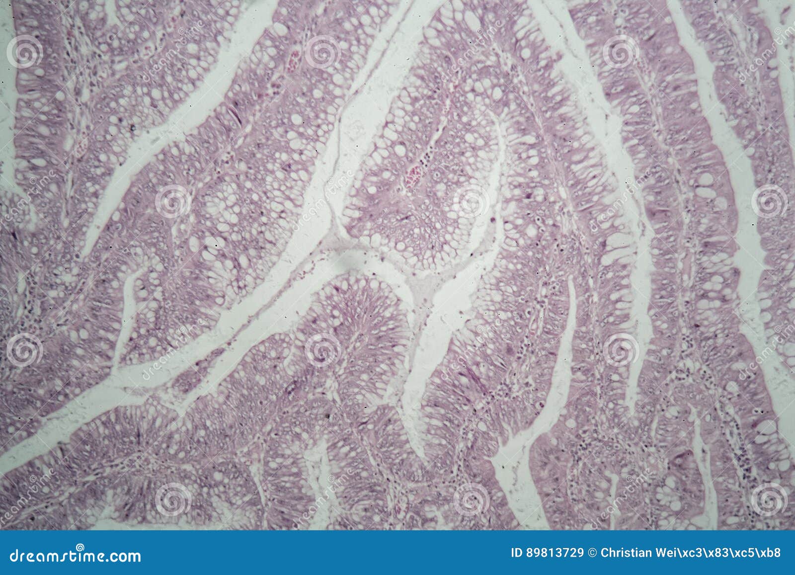 Cells of a Human Large Intestine Under the Microscope Stock Image ...