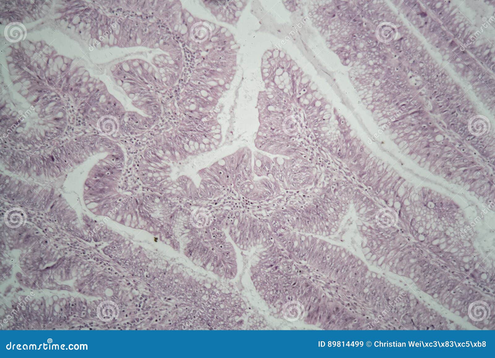 Cells of a Human Large Intestine Under the Microscope Stock Image ...