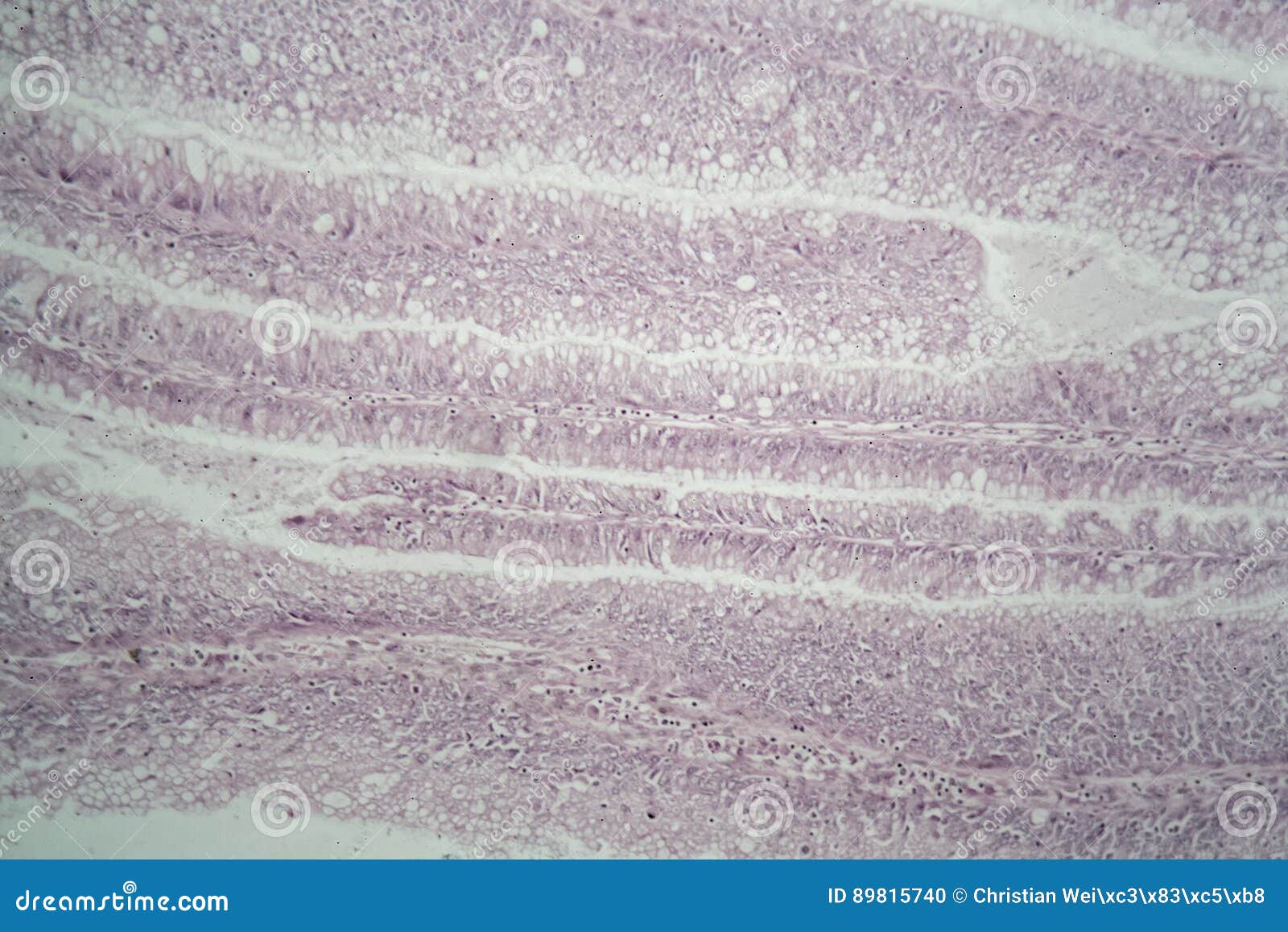 Cells of a Human Large Intestine Under the Microscope Stock Photo ...