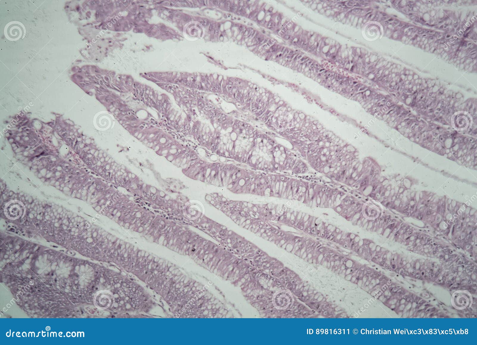Large Intestine Microscope