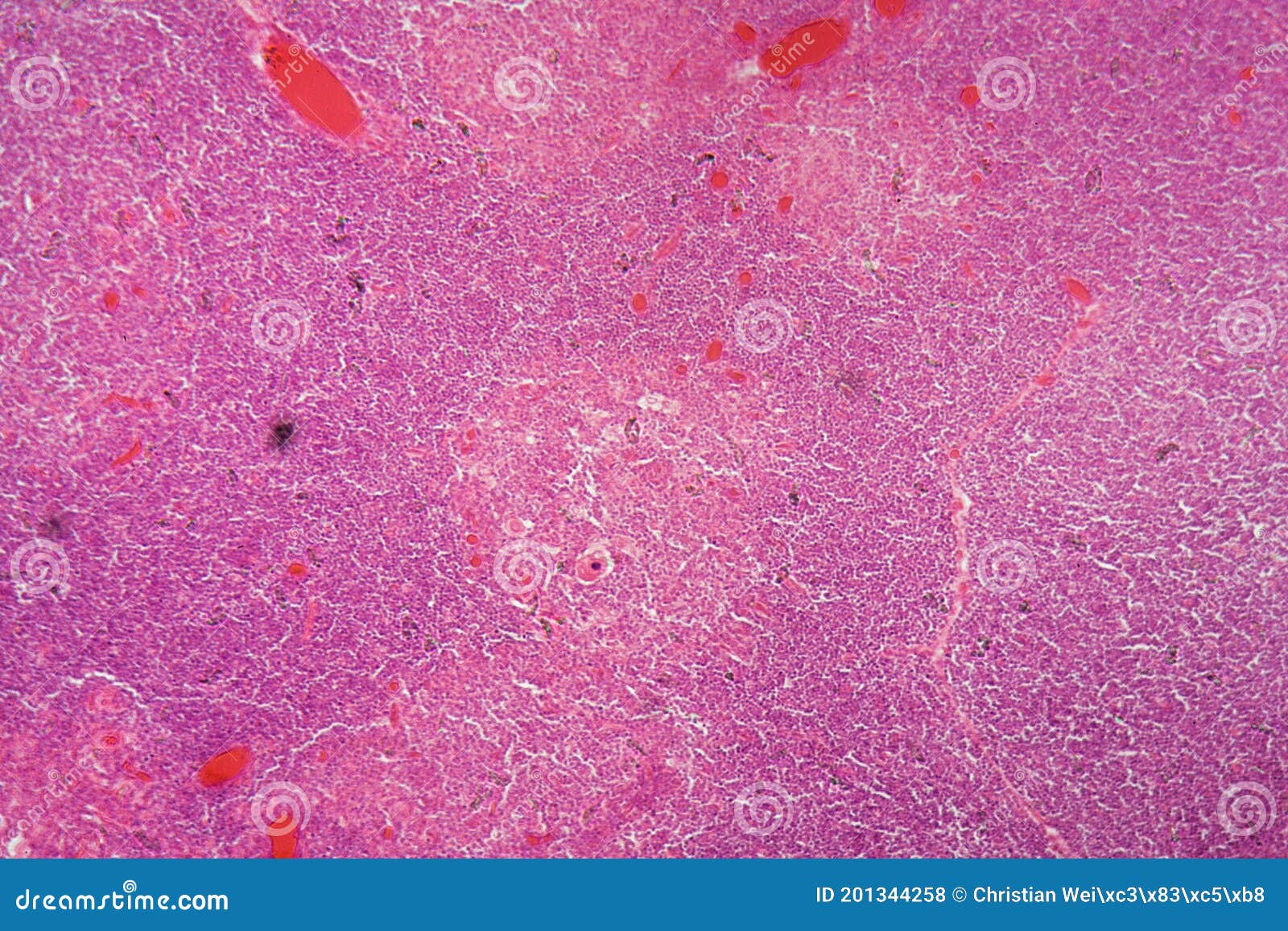 Cells of a Human Thymus Gland Under the Microscope Stock Photo - Image ...