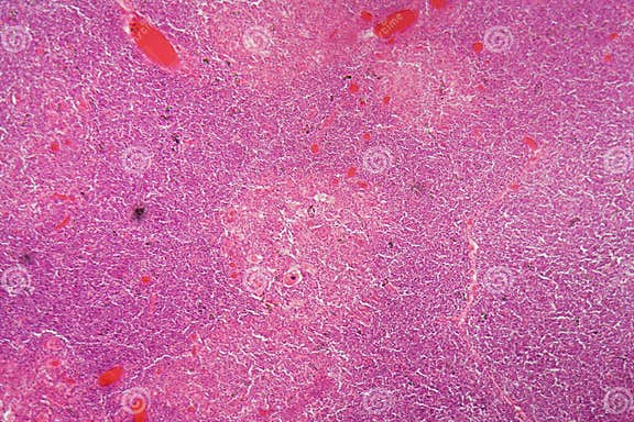 Cells of a Human Thymus Gland Under the Microscope Stock Photo - Image ...