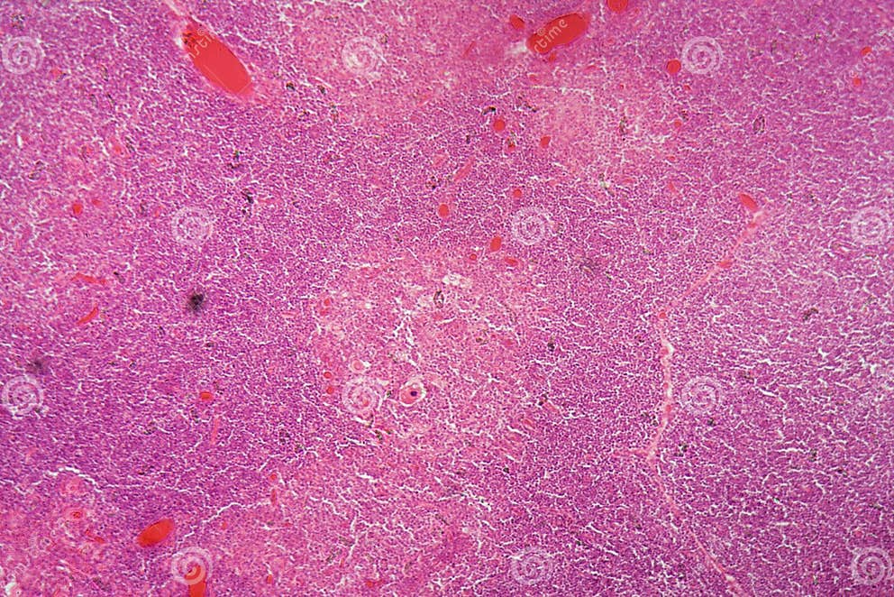 Cells of a Human Thymus Gland Under the Microscope Stock Photo - Image ...