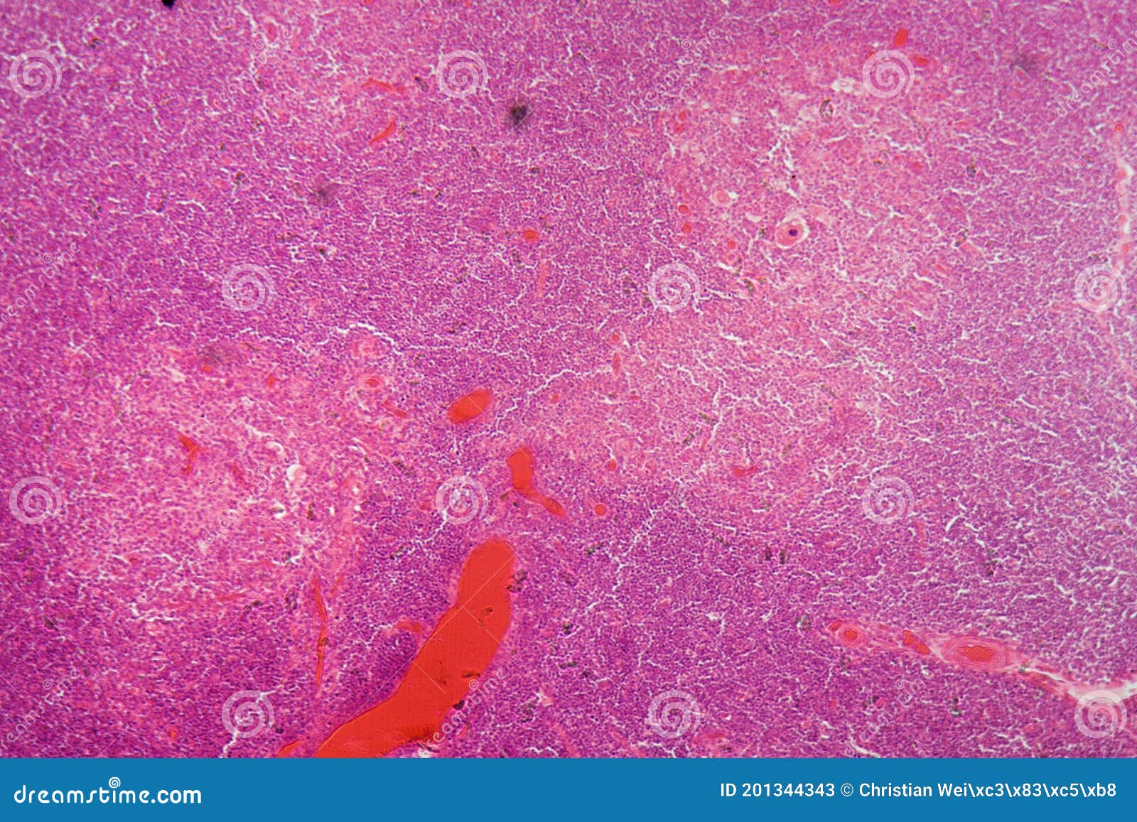 Cells of a Human Thymus Gland Under the Microscope Stock Image - Image ...