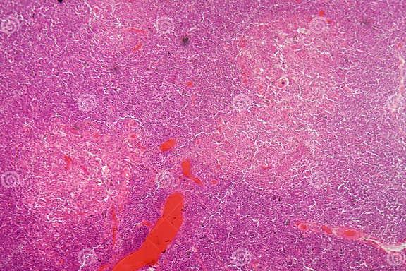 Cells of a Human Thymus Gland Under the Microscope Stock Image - Image ...