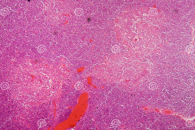 Cells of a Human Thymus Gland Under the Microscope Stock Image - Image ...