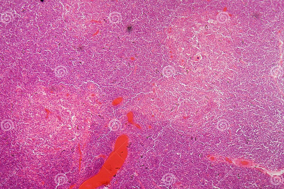 Cells of a Human Thymus Gland Under the Microscope Stock Image - Image ...