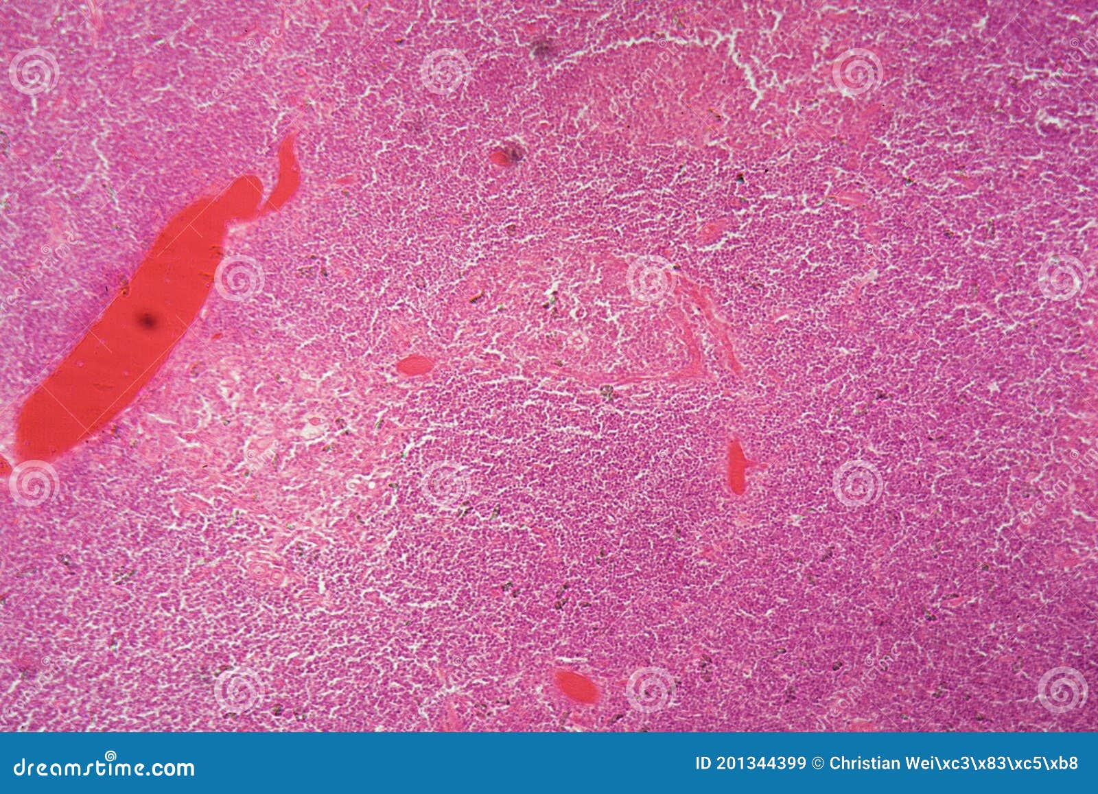 Cells of a Human Thymus Gland Under the Microscope Stock Image - Image ...