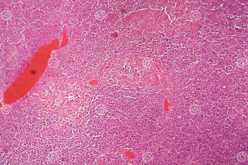 Cells of a Human Thymus Gland Under the Microscope Stock Image - Image ...