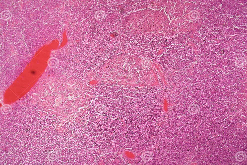 Cells of a Human Thymus Gland Under the Microscope Stock Image - Image ...