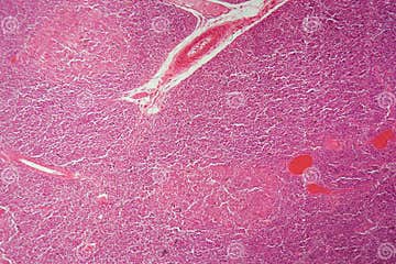 Cells of a Human Thymus Gland Under the Microscope Stock Image - Image ...