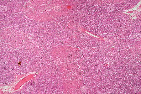 Cells of a Human Thymus Gland Under the Microscope Stock Image - Image ...