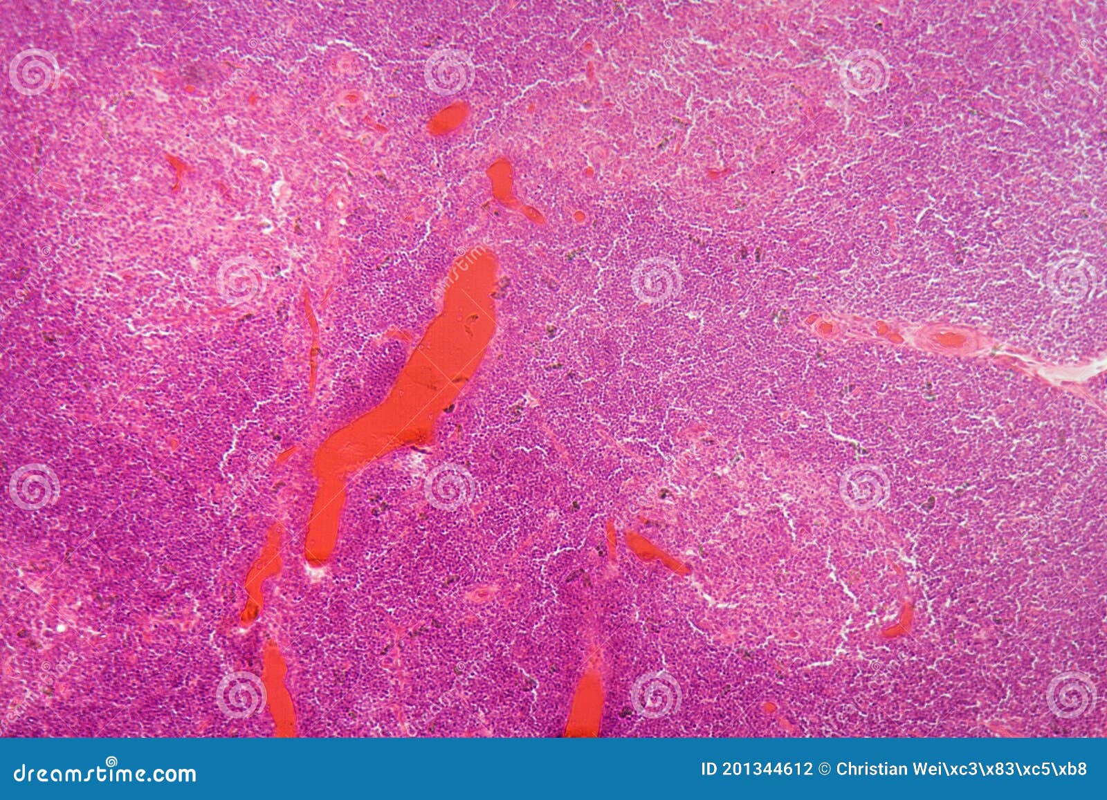 Cells of a Human Thymus Gland Under the Microscope Stock Photo - Image ...