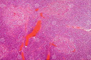 Cells of a Human Thymus Gland Under the Microscope Stock Photo - Image ...